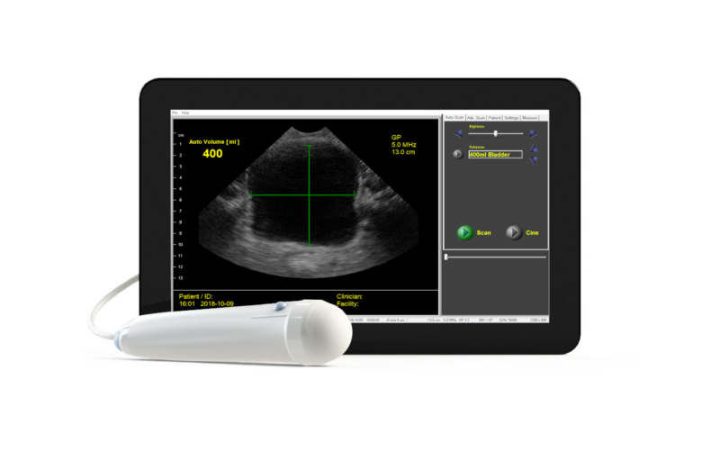 Point-of-Care USB Ultrasound for Bladder Scanning for Nursing & Long ...