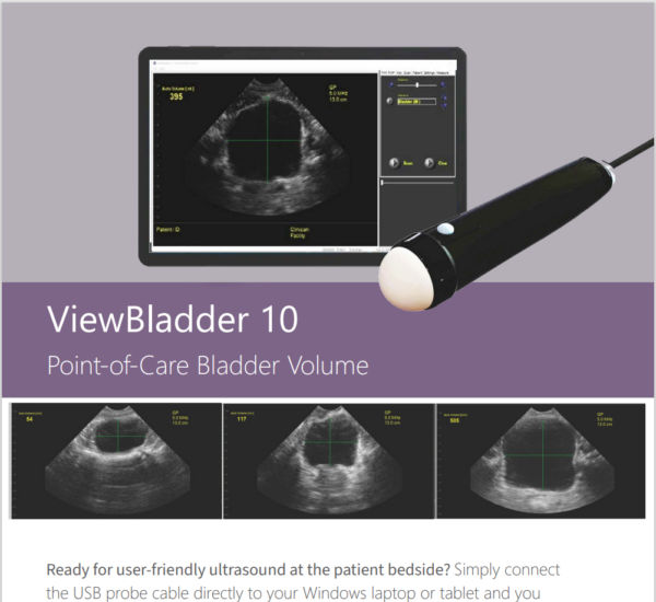 Point-of-Care USB Ultrasound for Bladder Scanning for Nursing & Long ...